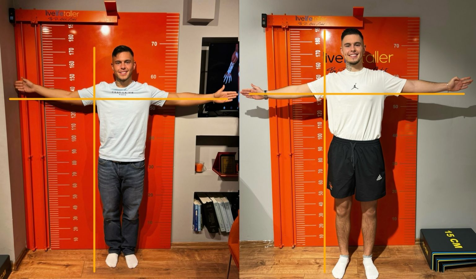 Height Surgery™ Consulting. Grow Taller in Just a Few Months